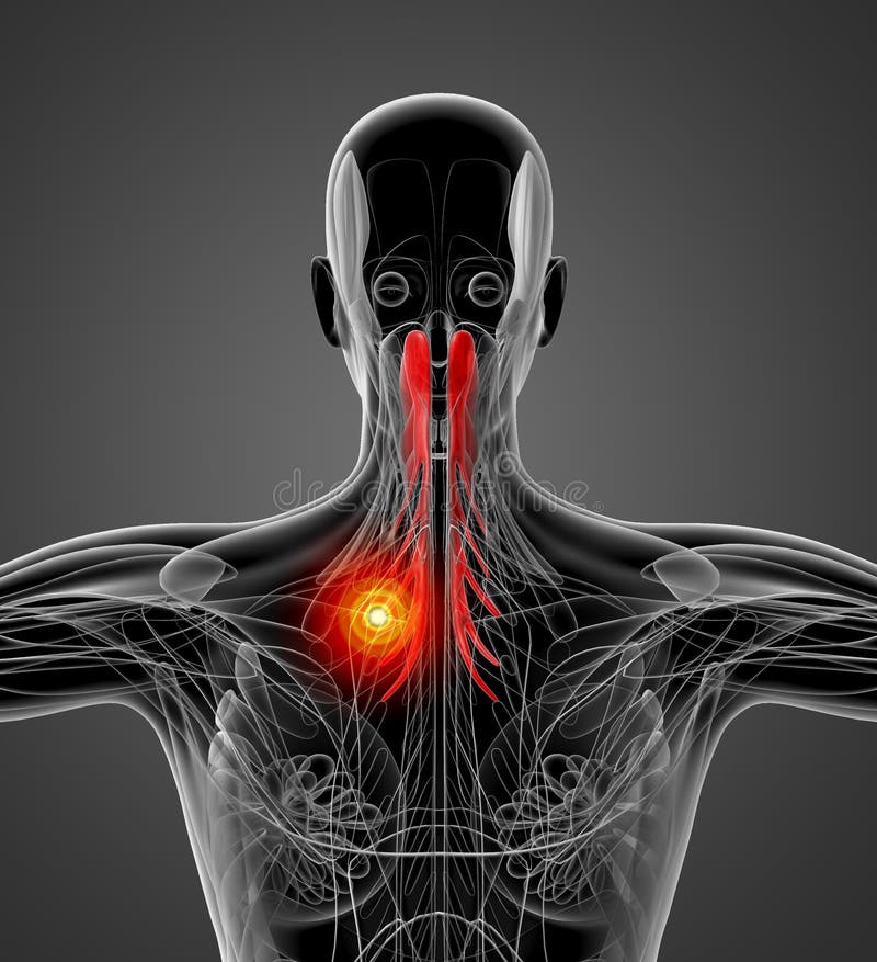 Medical Illustration of the Semispinalis Capitis Stock Illustration ...