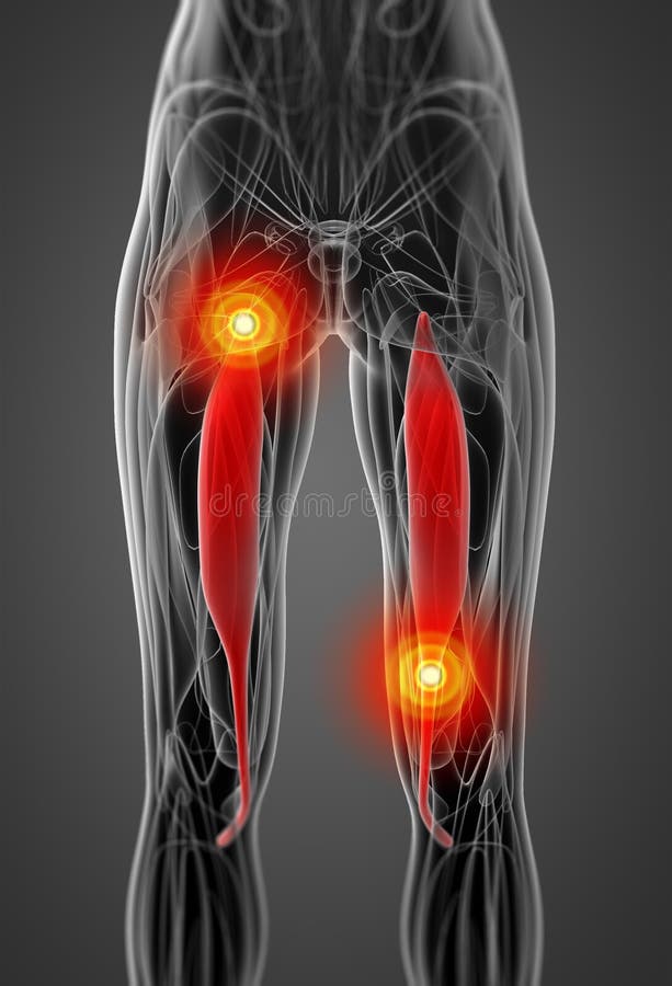 Medical Illustration of the Semitendinosus Stock Illustration ...