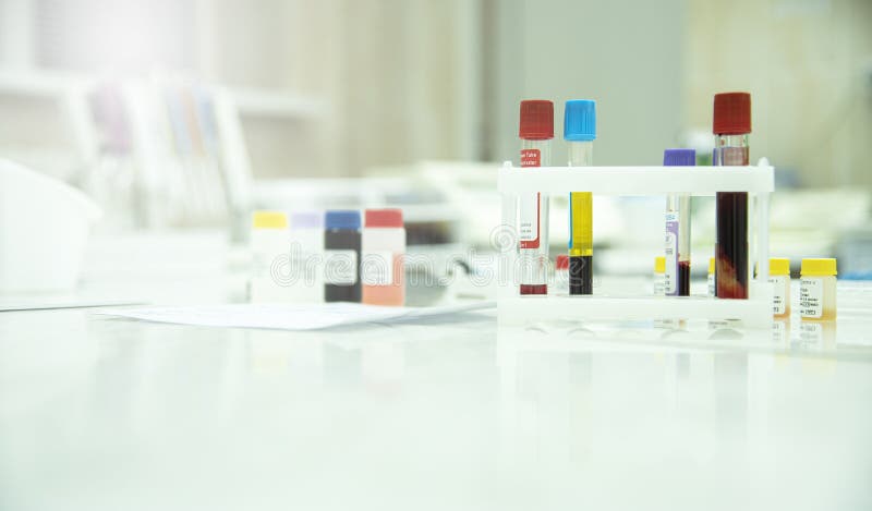 Medical Lab Equipment. Blood Test Medical Concept Stock Photo - Image ...