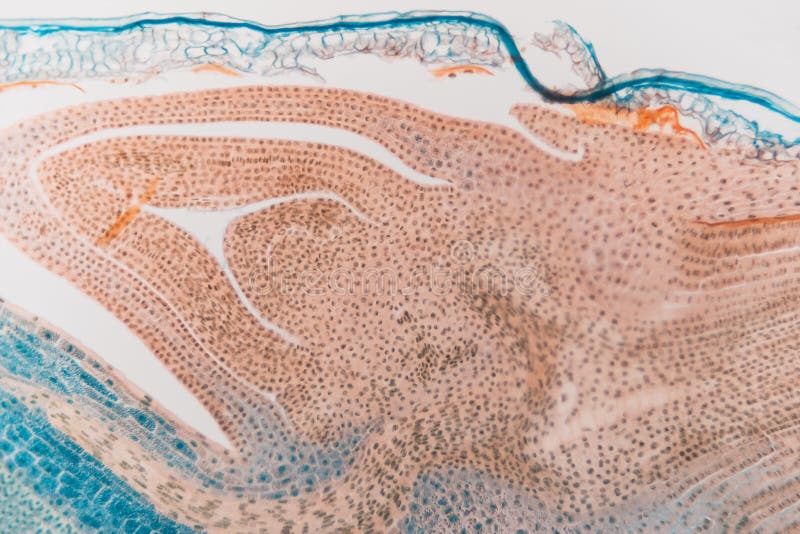 Medical Lab Prepared Microscopic- Weevil Rye Stock Photo - Image of ...