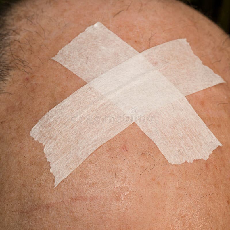 A Medical Patch on Man`s Head Stock Photo - Image of plaster, accident ...