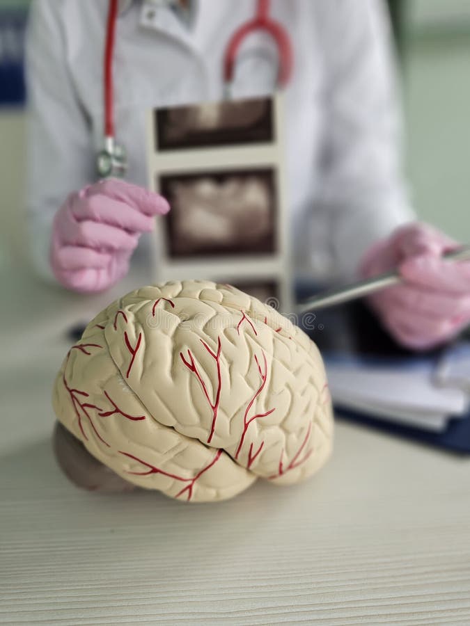 Medical Professional Discusses Neurological Anatomy Using a Brain Model ...