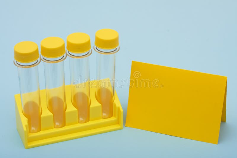 Yellow test tube. stock image. Image of flask, hand, isolated - 7390417