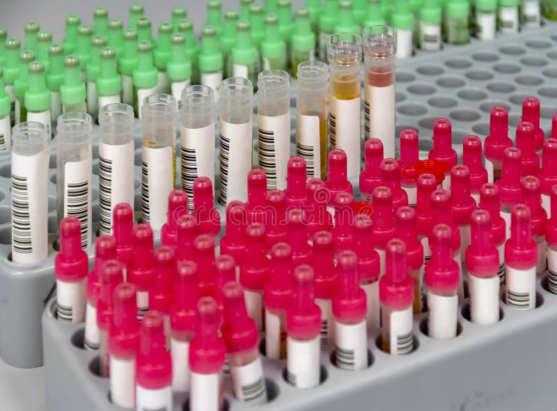 Medical sample racks stock photo. Image of chemistry - 135789096
