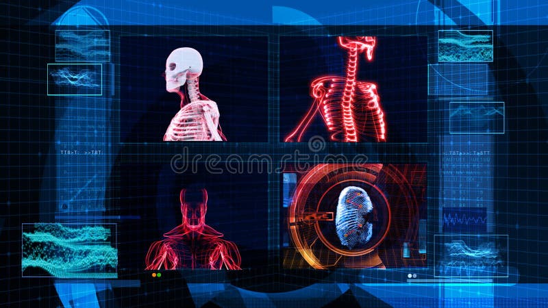 Digital X-Ray Scan of Human Body (HD) Stock Footage - Video of muscle ...