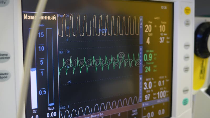 Screen of a Medical Monitor Displaying Diagrams of Vital Signs Stock ...