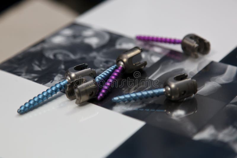 Medical screws for bones stock photo. Image of bone, snap - 16622212
