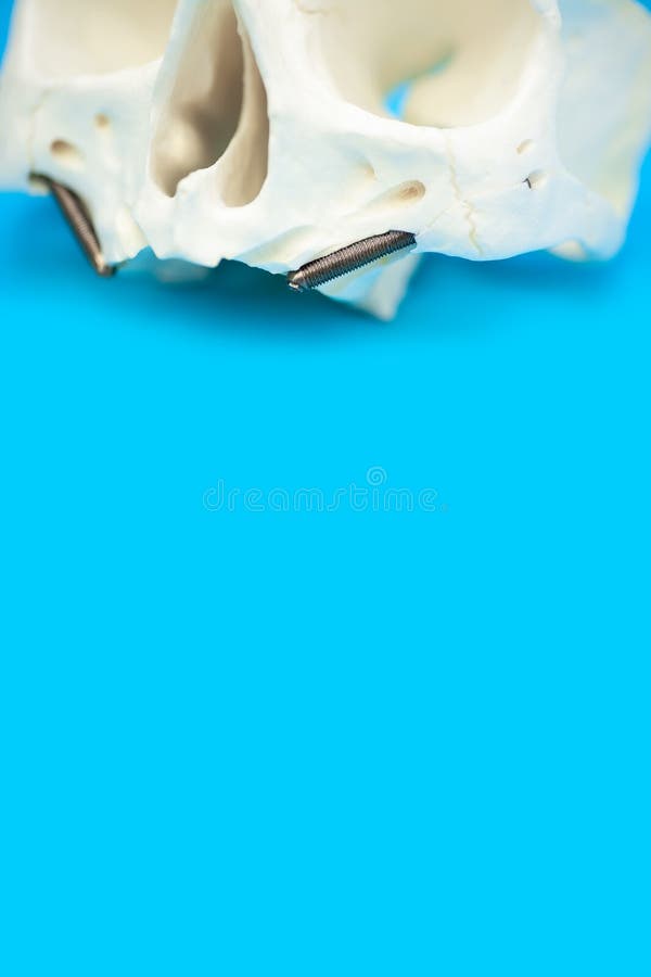 Medical Skull Pattern with False Teeth Pins on Blue Background Stock ...