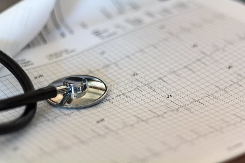 Ecg Graph Page Stock Photos - Free & Royalty-Free Stock Photos from ...