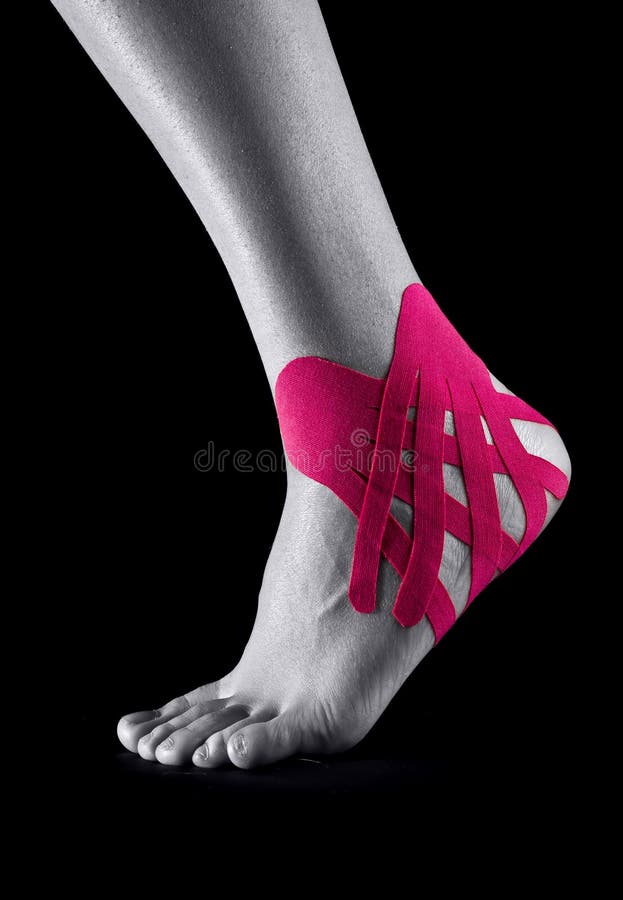 Medical Taping for Baker`s Cyst Treatment Showed on Young Model. Stock ...