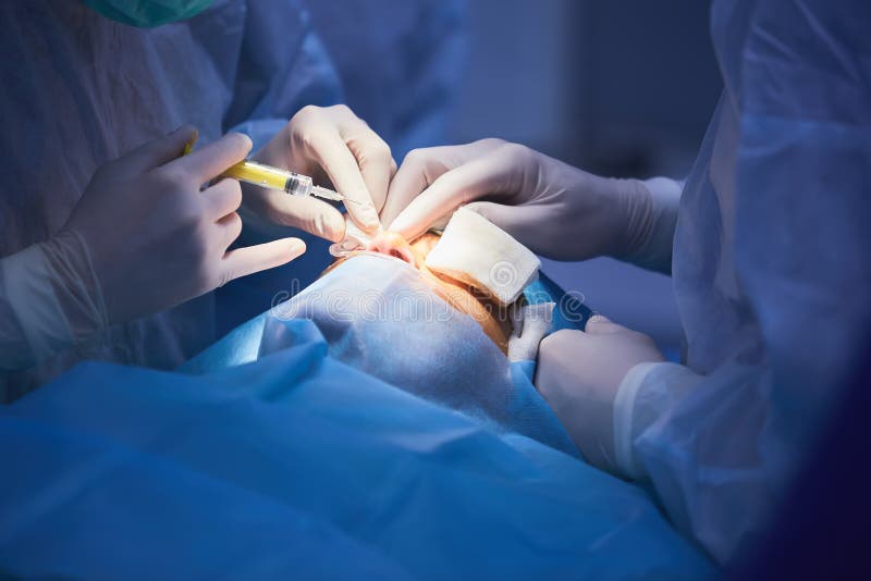 Medical Team Performing Surgical Operation in Modern Operating Room ...