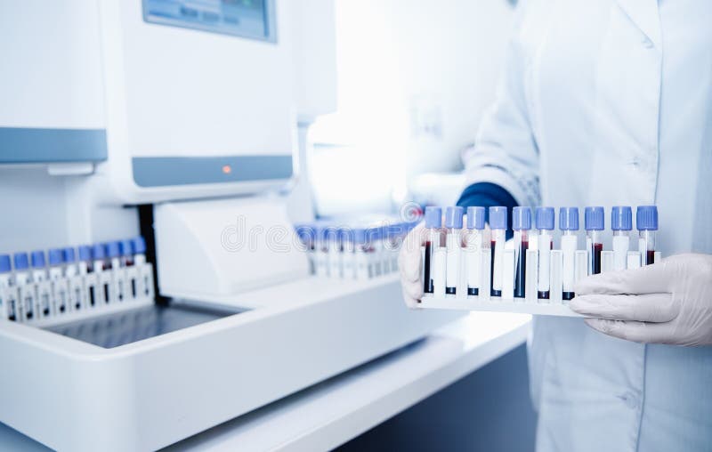 Laboratory Technician Sets Test Sample in Automatic Express Tester ...
