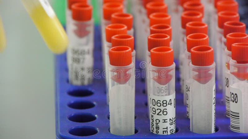 Medical Test Sample Tubes Beaker with Analyzes. Analyzing Samples ...