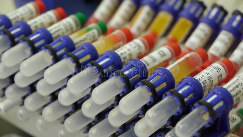 Medical Test Sample Tubes Beaker with Analyzes. Analyzing Samples ...