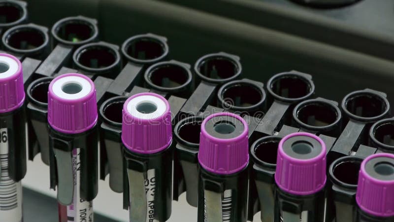 Medical Test Sample Tubes Beaker with Analyzes. Analyzing Samples ...