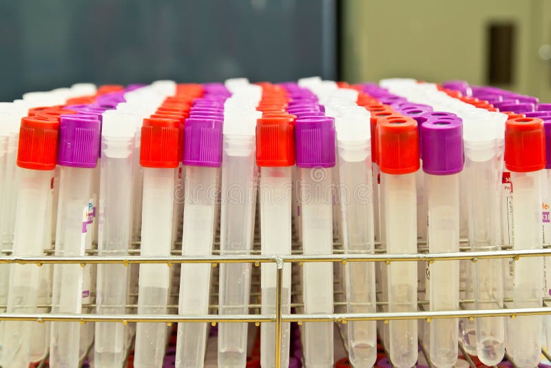 Medical test-tube stock image. Image of microbiology - 31488897