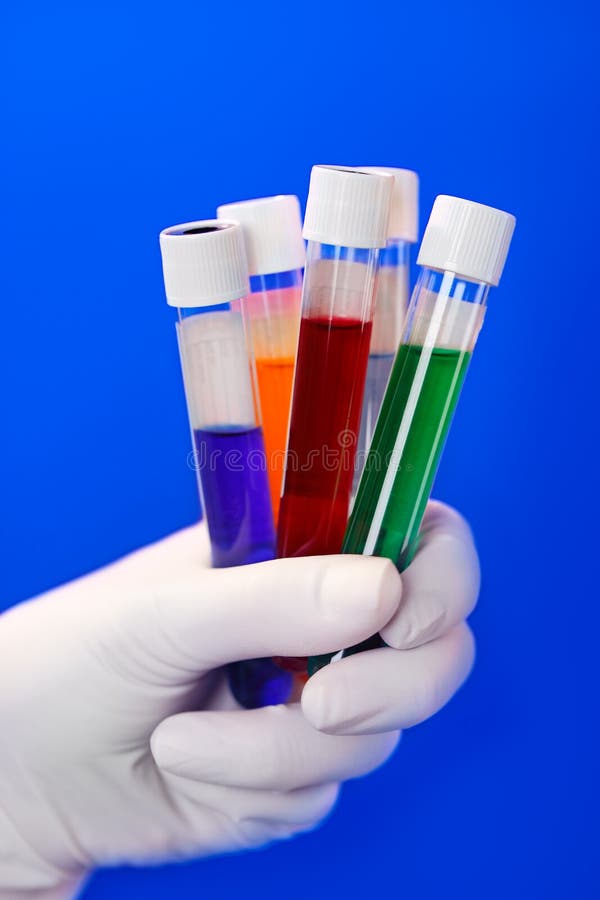 Medical Test Tubes with Fluid Sample on Blue Stock Photo - Image of ...