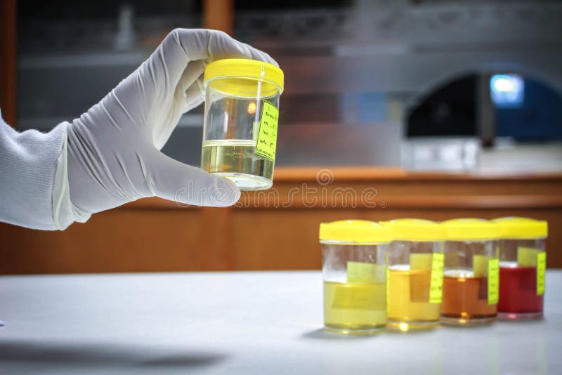 Medical urine test stock image. Image of surgeon, hospital - 80360571