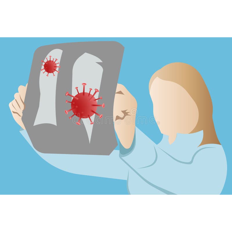 A Medical Worker Examines a Lung Scan. Vector Image. Stock Vector ...