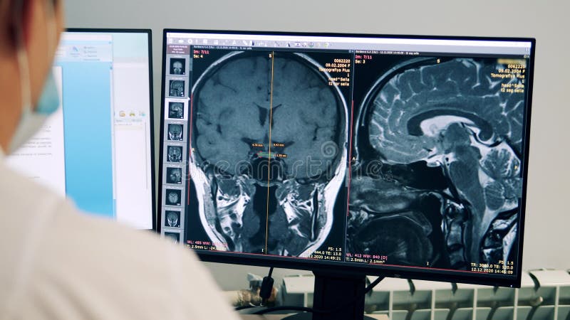 CT Scan or Computer Tomography of a Whole Abdomen of a Man. Stock ...