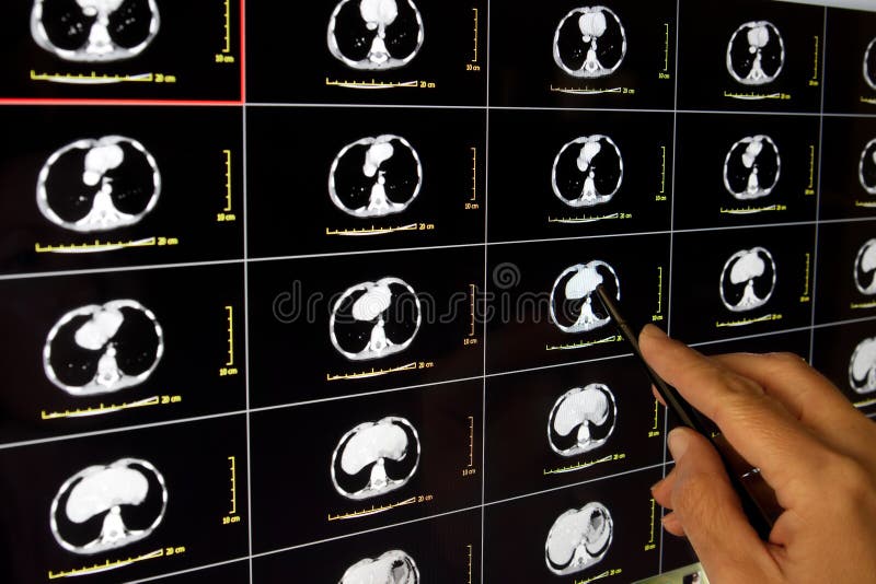 Medical Xray diagnosis stock photo. Image of body, skeleton - 27166508