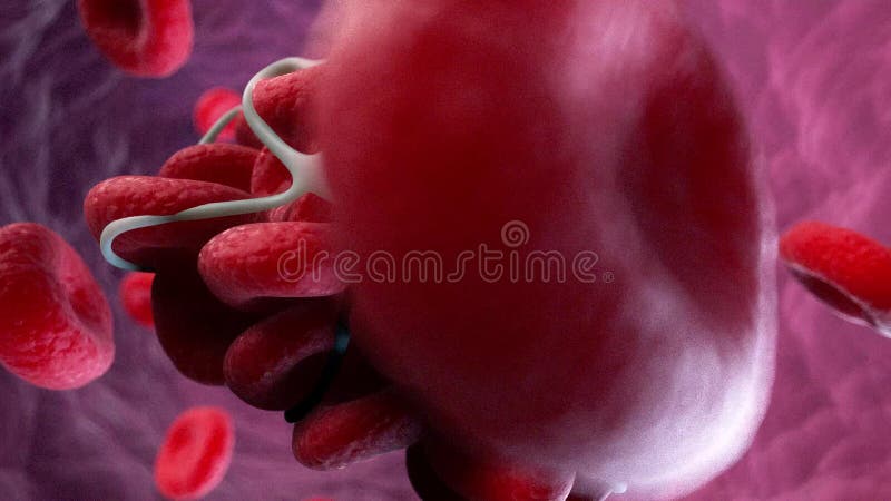 Blood Clot 3d animation stock footage. Video of clot - 119135242