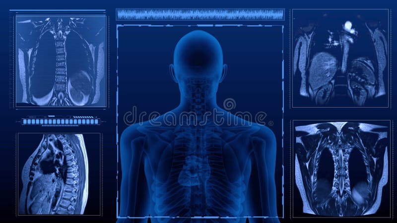 A Medically Anatomically Correct Magnetic Resonance Scan of the Heart ...