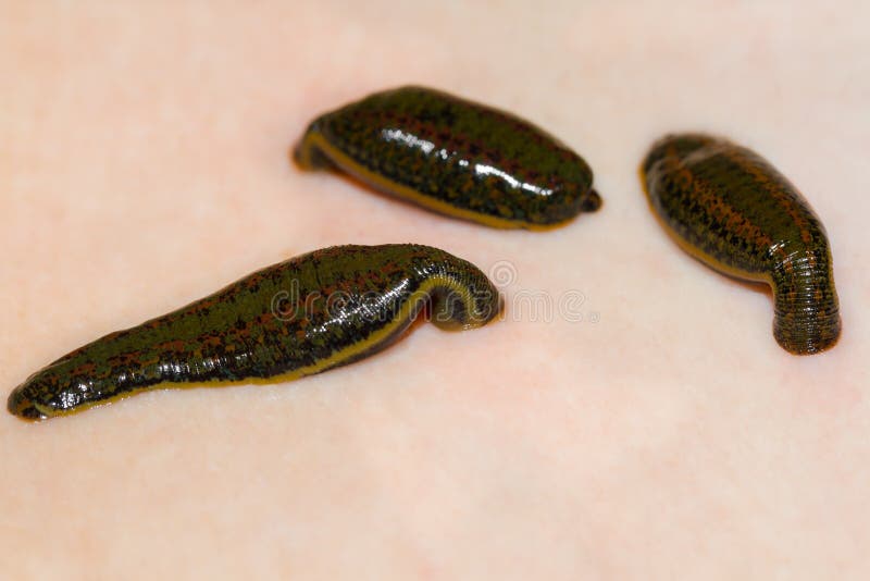 Sanguijuela-hirudo Medicinal Foto de archivo - Imagen de manchado ...