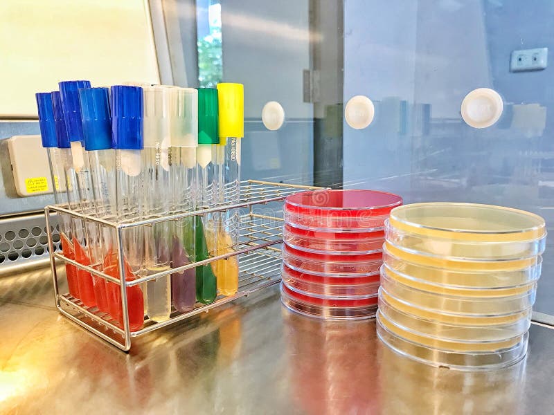 Medio de cultivo fotografía editorial. Imagen de media - 110190907