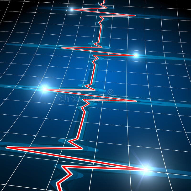Medische Hartfrequentie, Harttarief Controle Stock Afbeelding - Image ...
