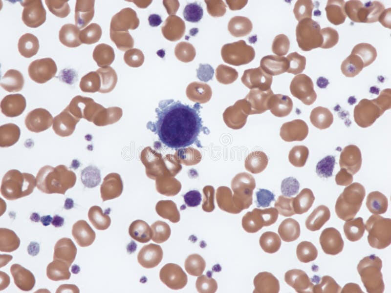 Cytoplasmic Blebs Stock Photos - Free & Royalty-Free Stock Photos from ...