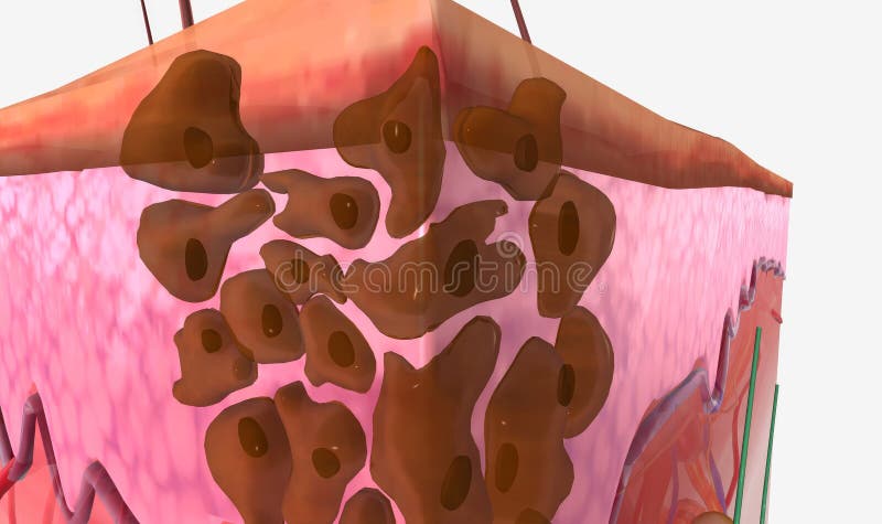 Cutaneous Nerve Stock Illustrations – 139 Cutaneous Nerve Stock ...