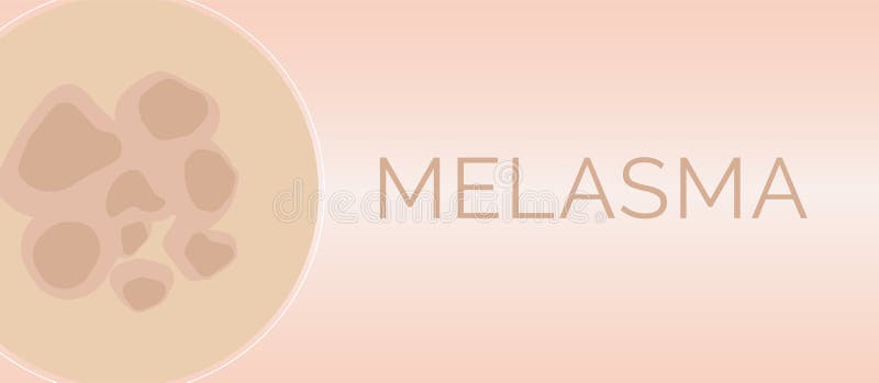 Melasma Icon Stock Illustrations – 57 Melasma Icon Stock Illustrations ...