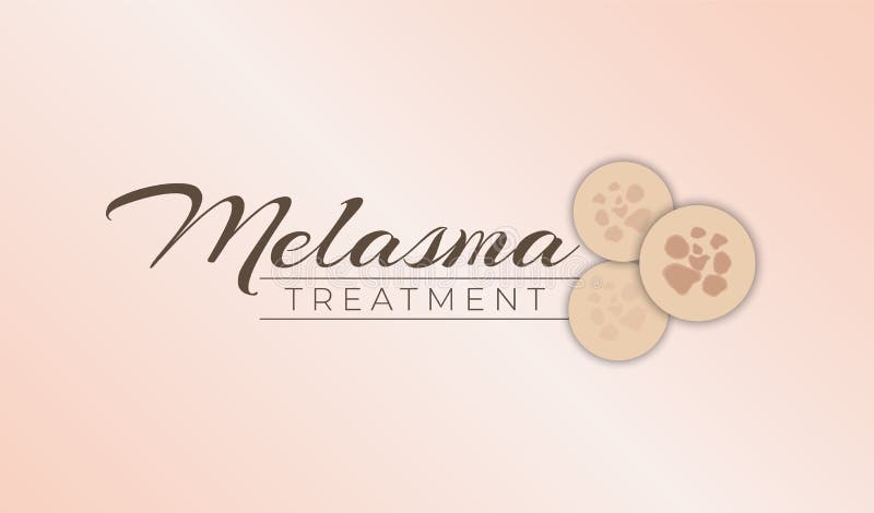 Melasma Icon Stock Illustrations – 58 Melasma Icon Stock Illustrations ...