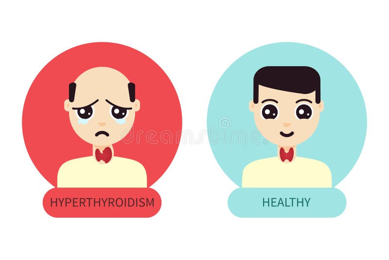 Gland with Healthy Thyroid and Hyperthyroid Disorder Stock Vector ...