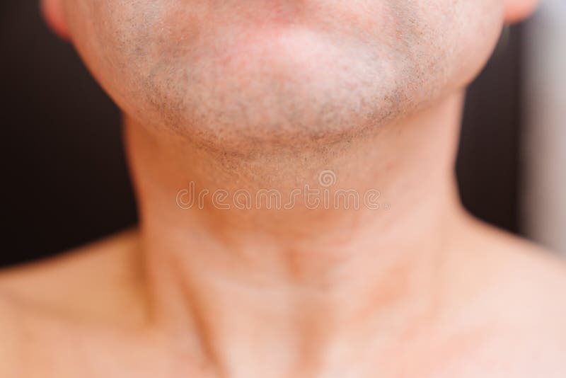 Men& X27;s Chin. Selective Focus. Skin after Shaving Stock Image ...