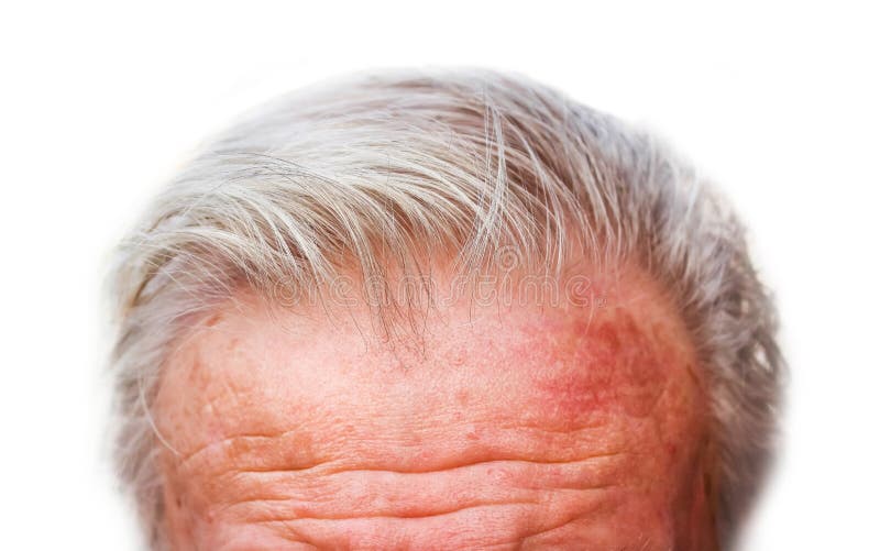 Men `s Forehead Wrinkles and Going To Gray Hair Isolated on White ... Men `s Forehead Wrinkles and Going To Gray Hair Isolated on White ...