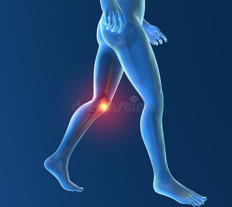 Men S Skeleton, Knee Inflammation Stock Illustration - Illustration of ...