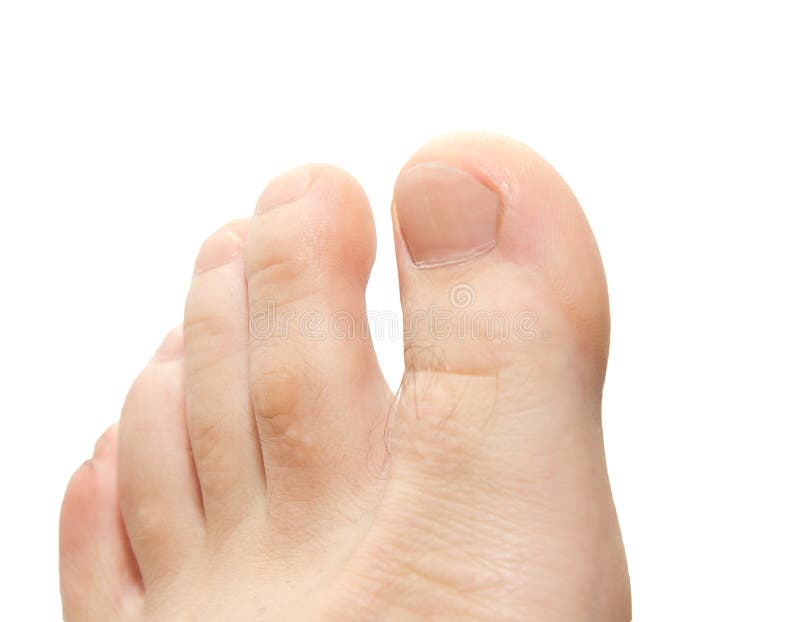 Men s toes stock image. Image of callosity, isolated - 29745041