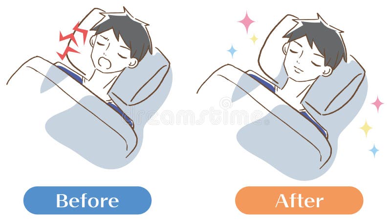 Men who grind teeth set stock vector. Illustration of healthy - 164793124