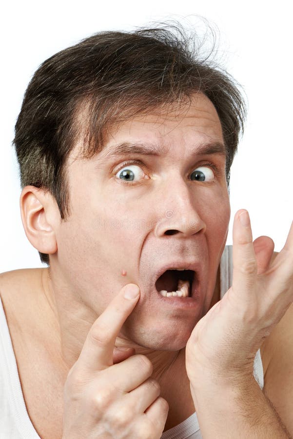 Man Die Een Puist Uitknijpt Stock Afbeelding - Image of omhelzing ...