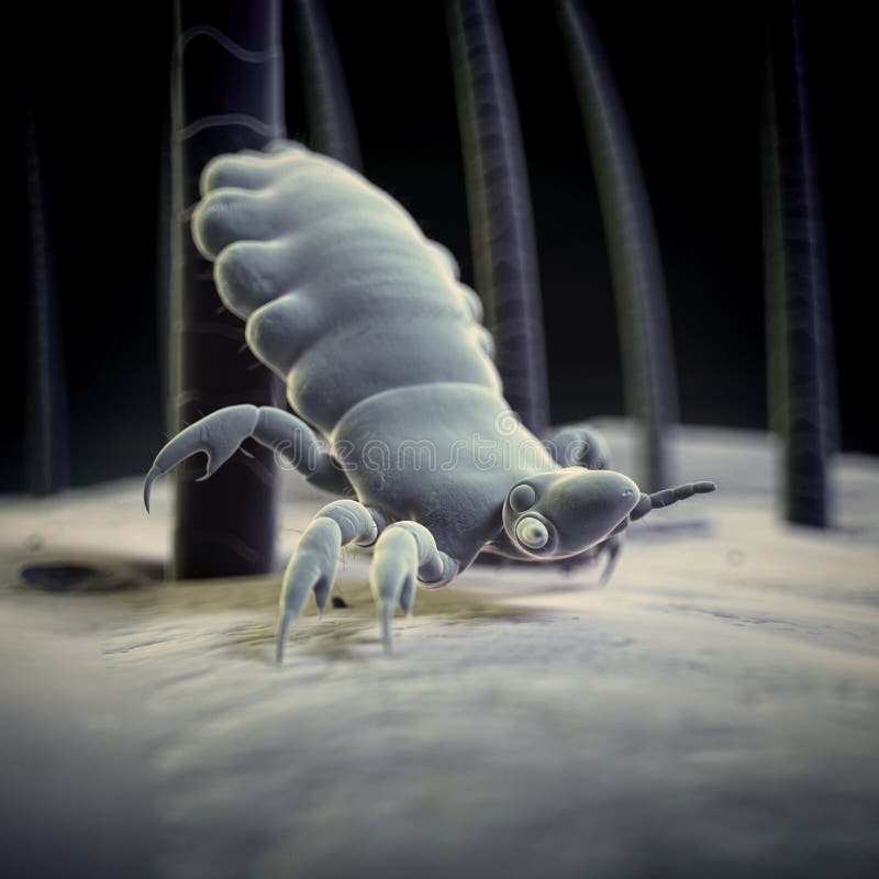 Menschliche Kopflaus stock abbildung. Illustration von anatomie - 38864405