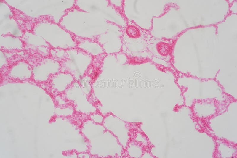 Menschliches Lungengewebe Unter Mikroskopansicht Stockbild - Bild von ...