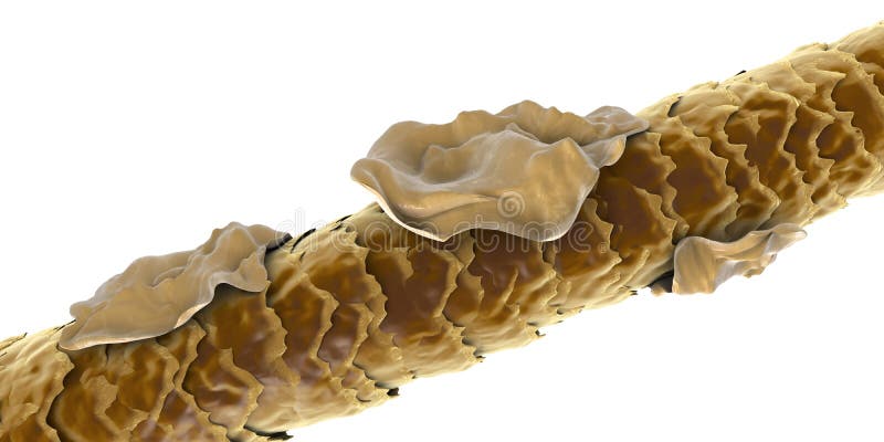 Menselijk Haar Met Roos En Close-upvisie Van Microscopische Schimmels ...