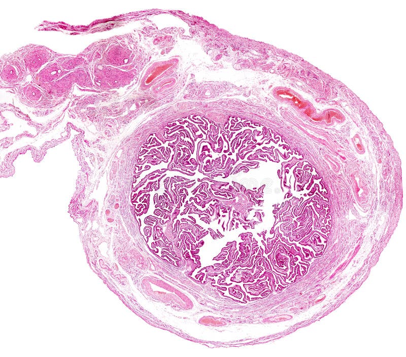 Menselijke eileider stock foto. Image of buis, buizen - 93291784