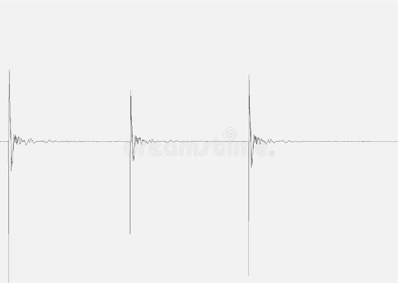 Royalty-Free Mercedes Benz E-Class W124 1984 Executive Car Window Knock ...