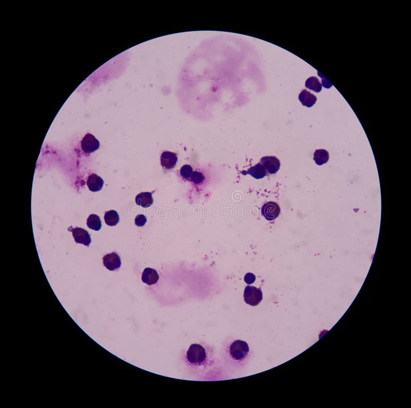 Mesothelial cells stock photo. Image of marrow, lymphocyte - 67925892