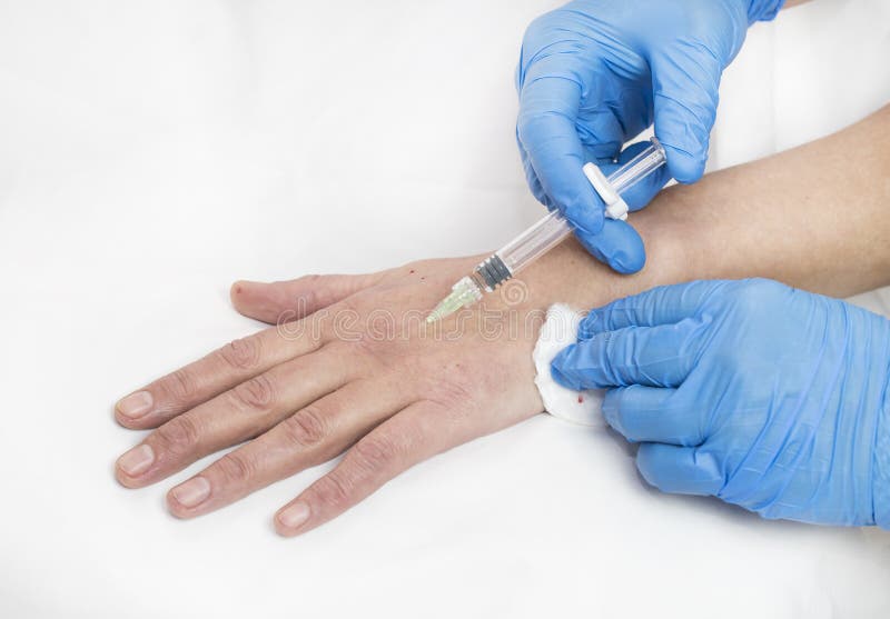 Mesotherapy Process on a Female Hand Stock Photo - Image of medical ...
