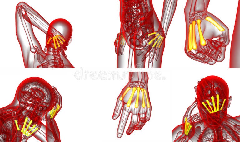 Metacarpal bone stock illustration. Illustration of rheumatism - 88884881