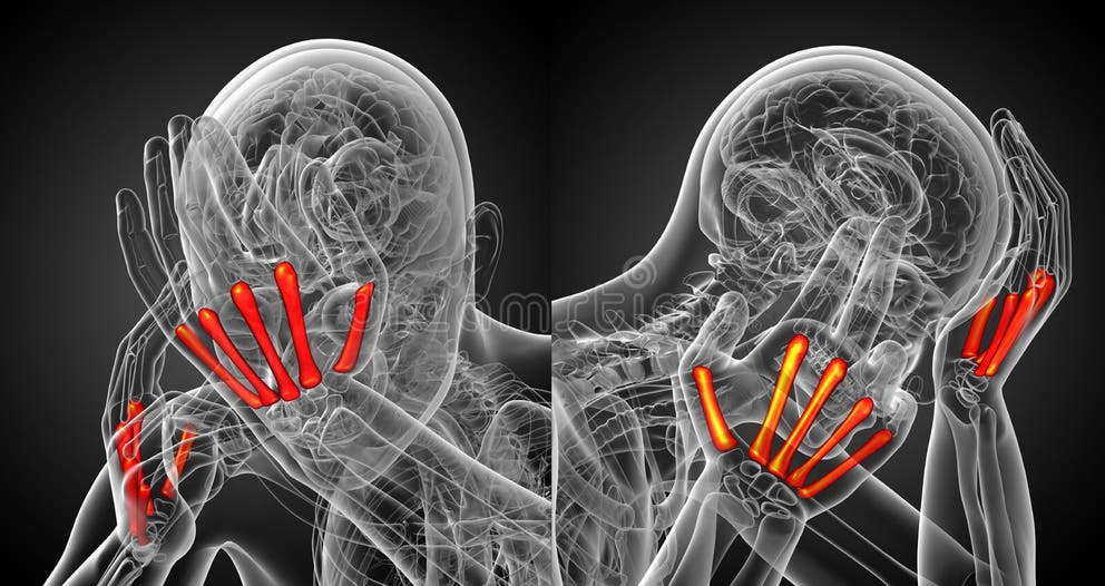 Metacarpal bone stock illustration. Illustration of joint - 88892709
